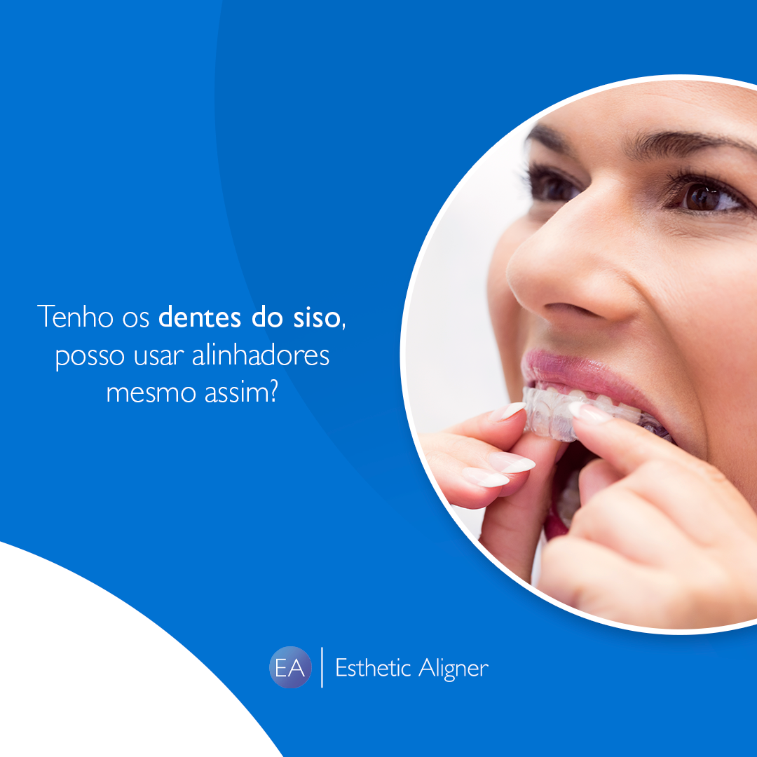 10-ea-institucional-post - Esthetic Aligner