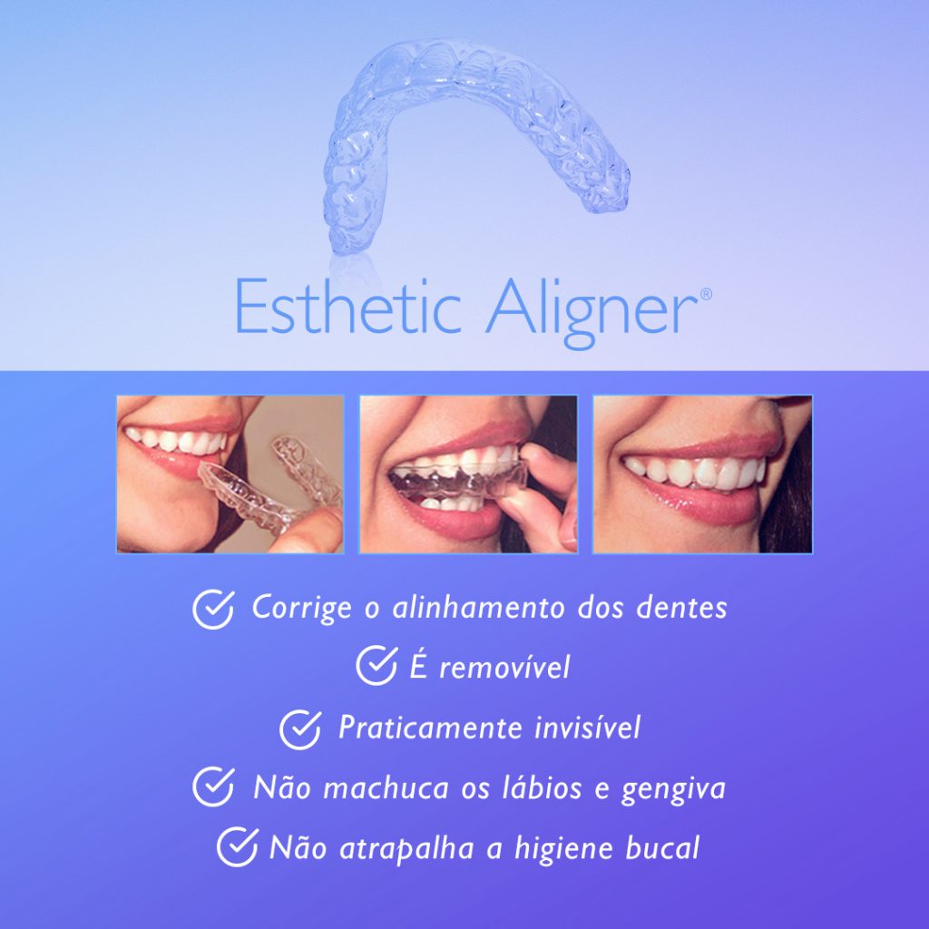 ea_002 - Esthetic Aligner